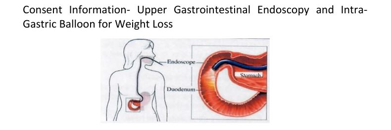 Endoscopy Balloon Placement Consent Form